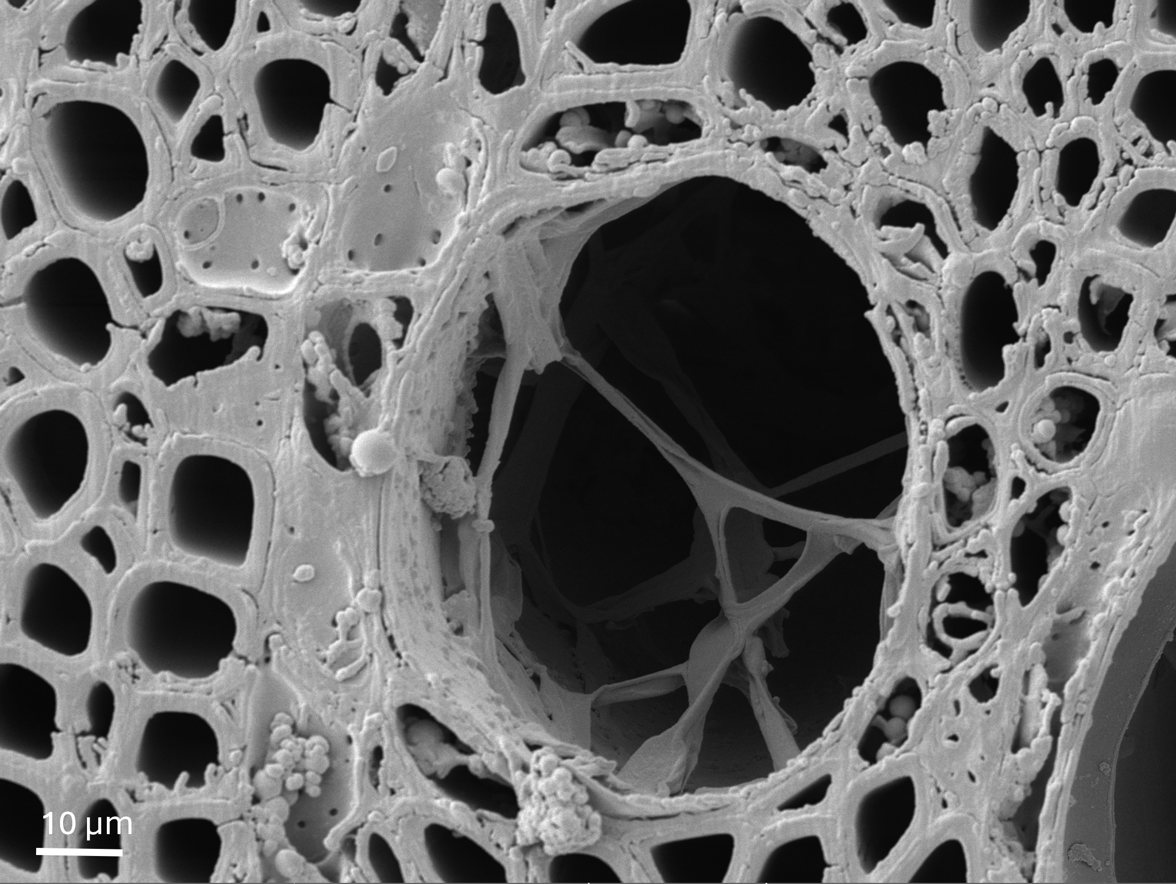Cryo-SEM Fungal Analysis in Plants | Tescan CLARA Workflow